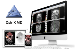OsiriX Overview – Inspire Meditech Pvt.ltd.